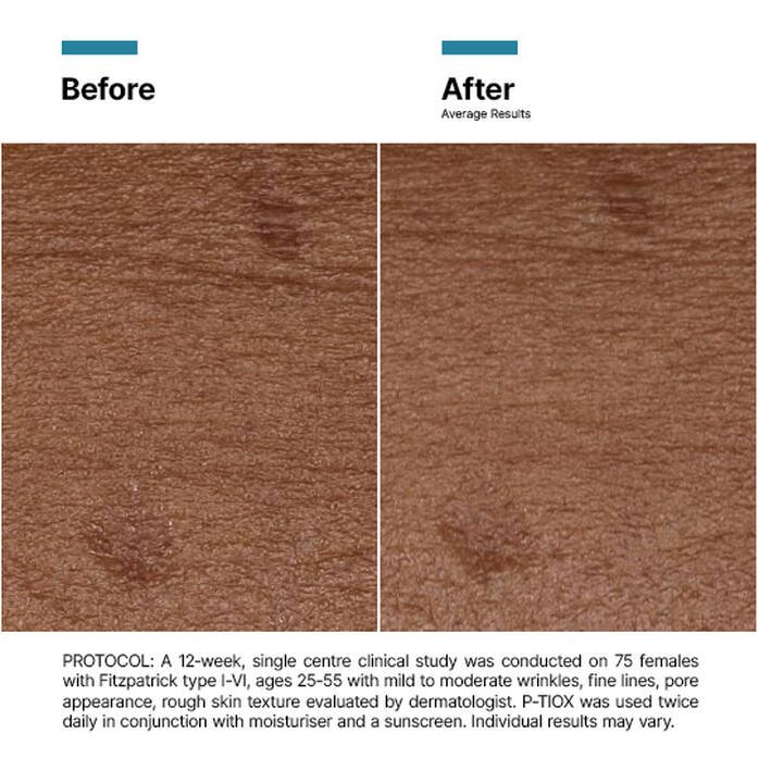 SkinCeuticals P-TIOX - Bespoke Medical Clinic